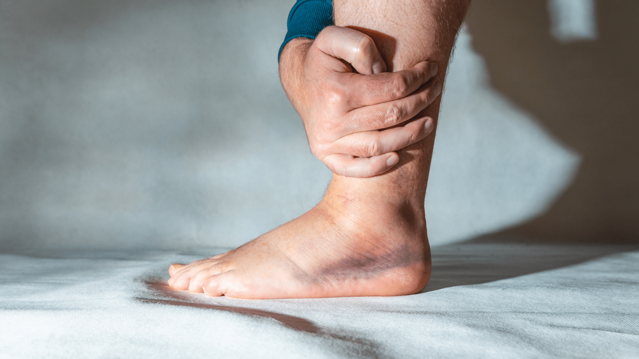 How Can You Tell If You've Sprained Something: Spotting the Signs Early ...