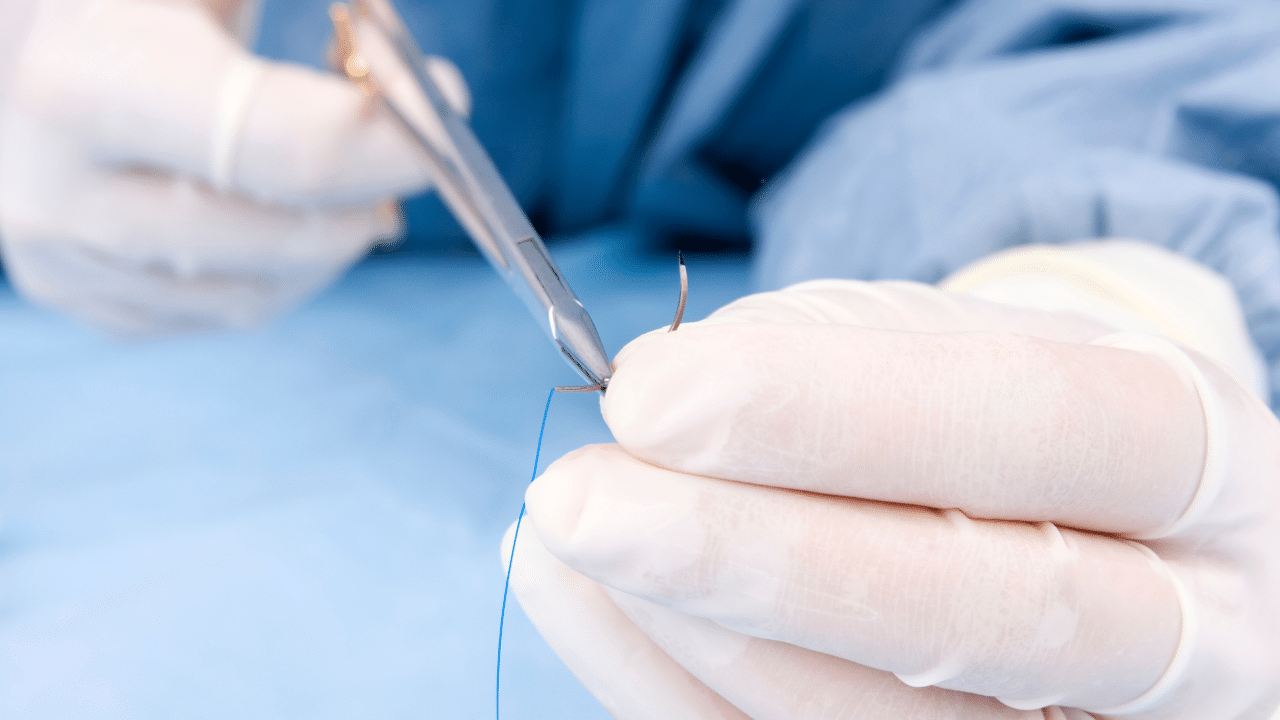 How Do Wound Stitches Dissolve? - First Choice Immediate Care