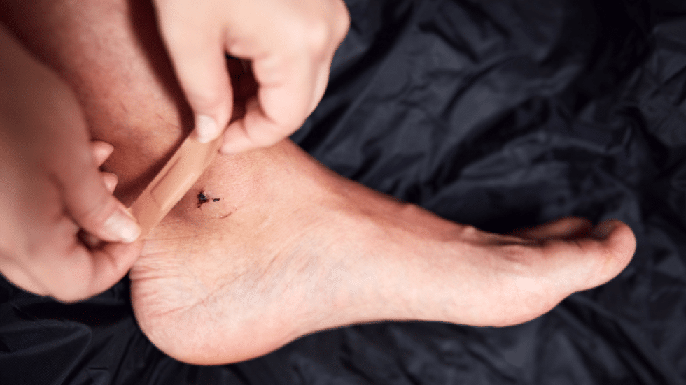 How Urgent Is Medical Attention for Different Types of Puncture Wounds ...