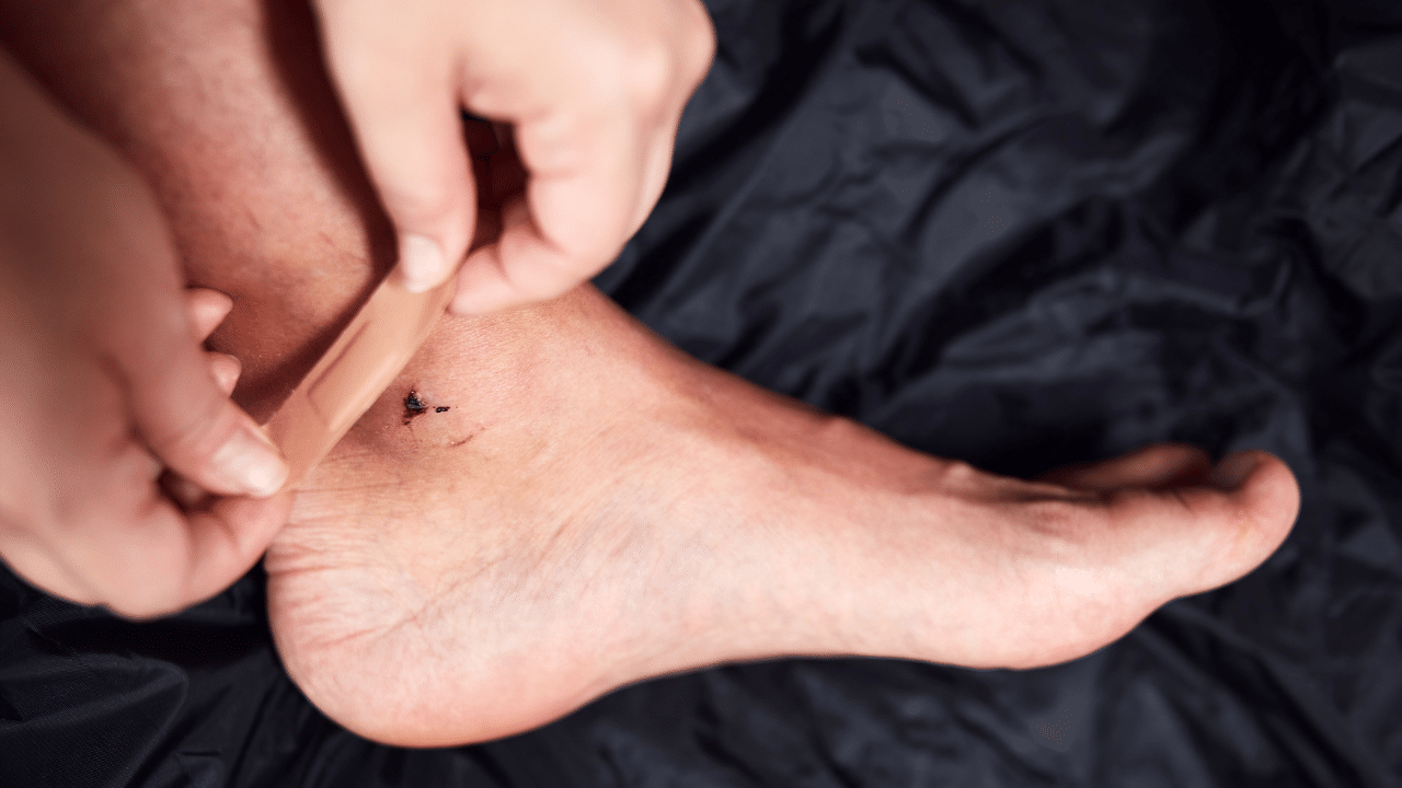 How Urgent Is Medical Attention for Different Types of Puncture Wounds ...