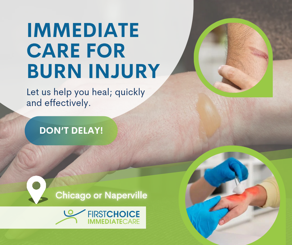 Best Burn Injuries Treatment in Chicago & Naperville