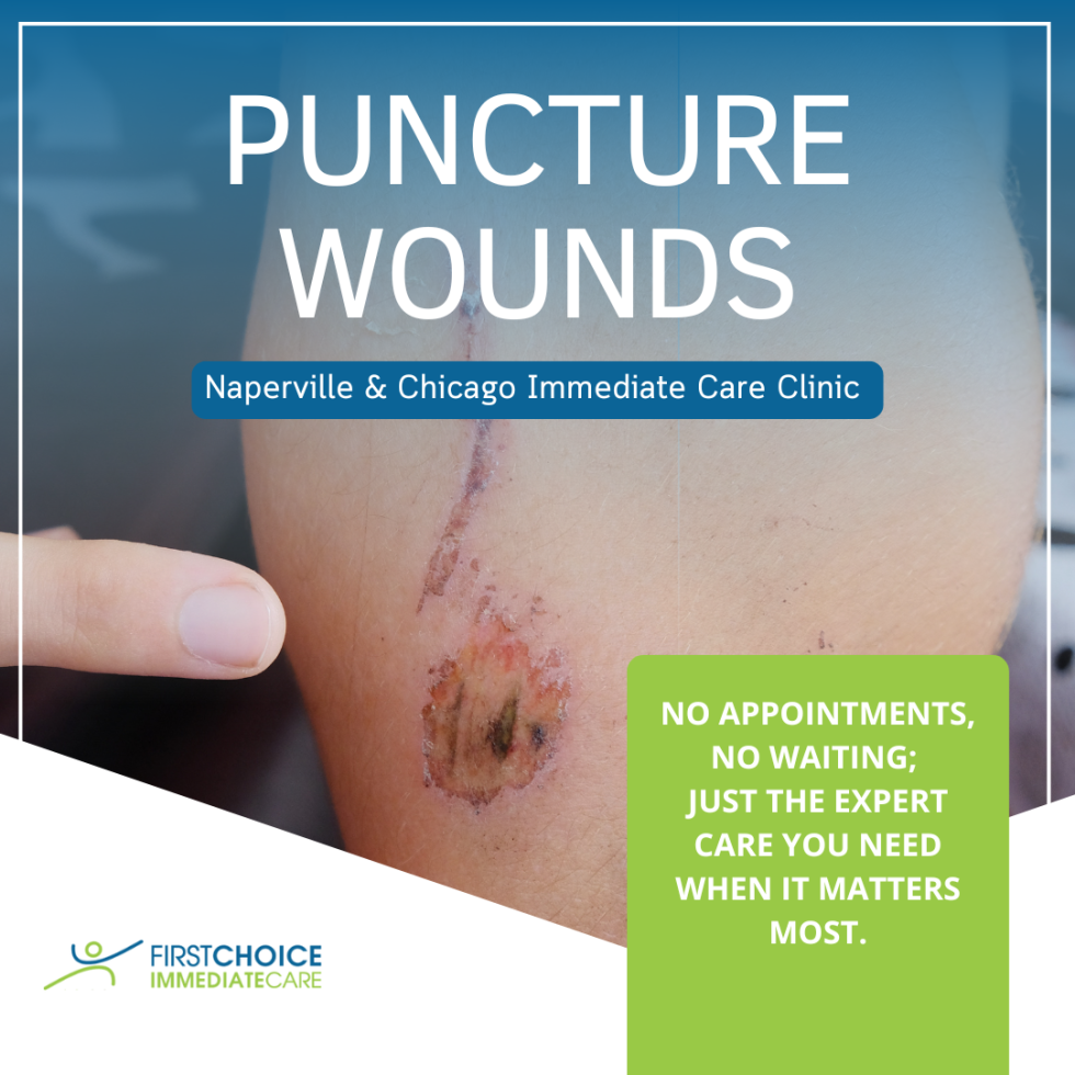 Best Puncture Wounds Treatment in Chicago & Naperville