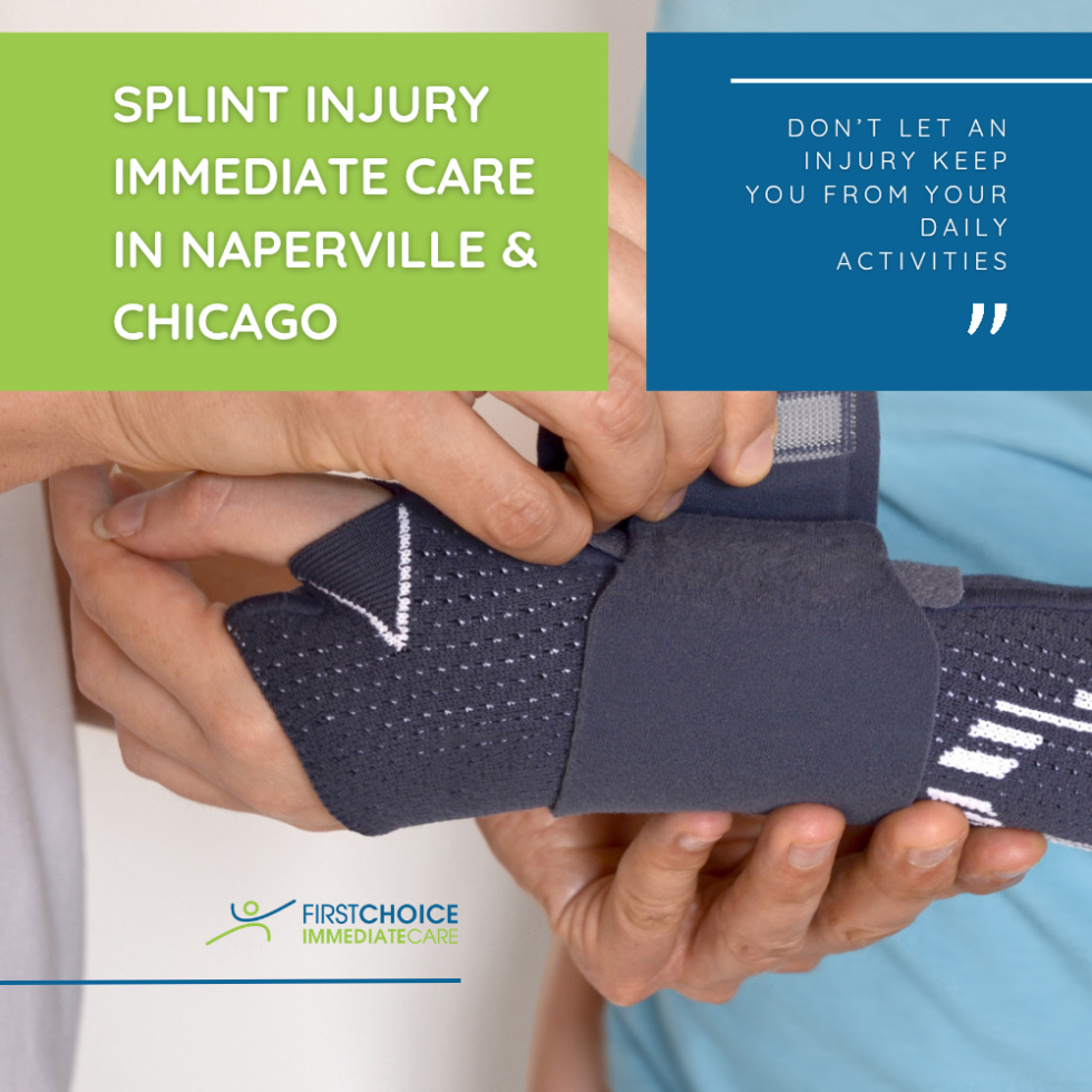 Best Splints Treatment in Chicago & Naperville