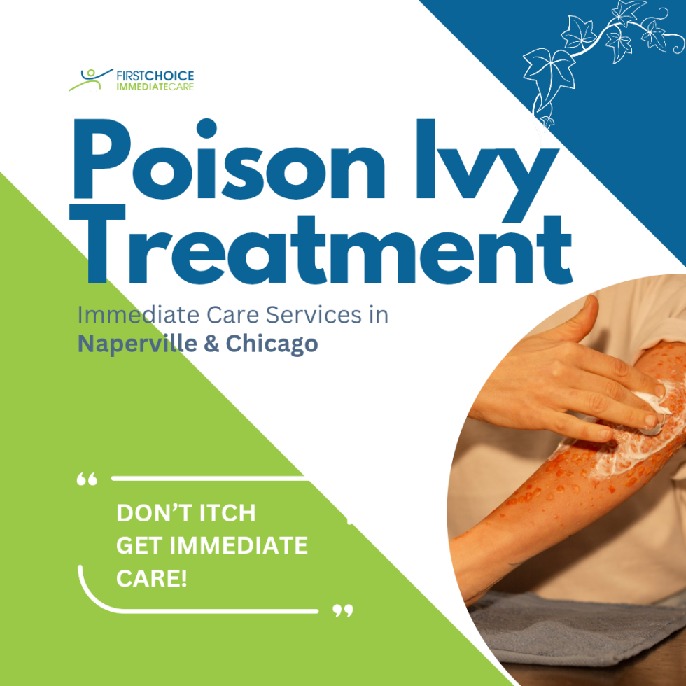 Best Poison Ivy Treatment in Chicago & Naperville